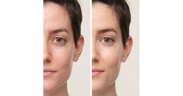 No.1 Active Light® Under-eye Concealer